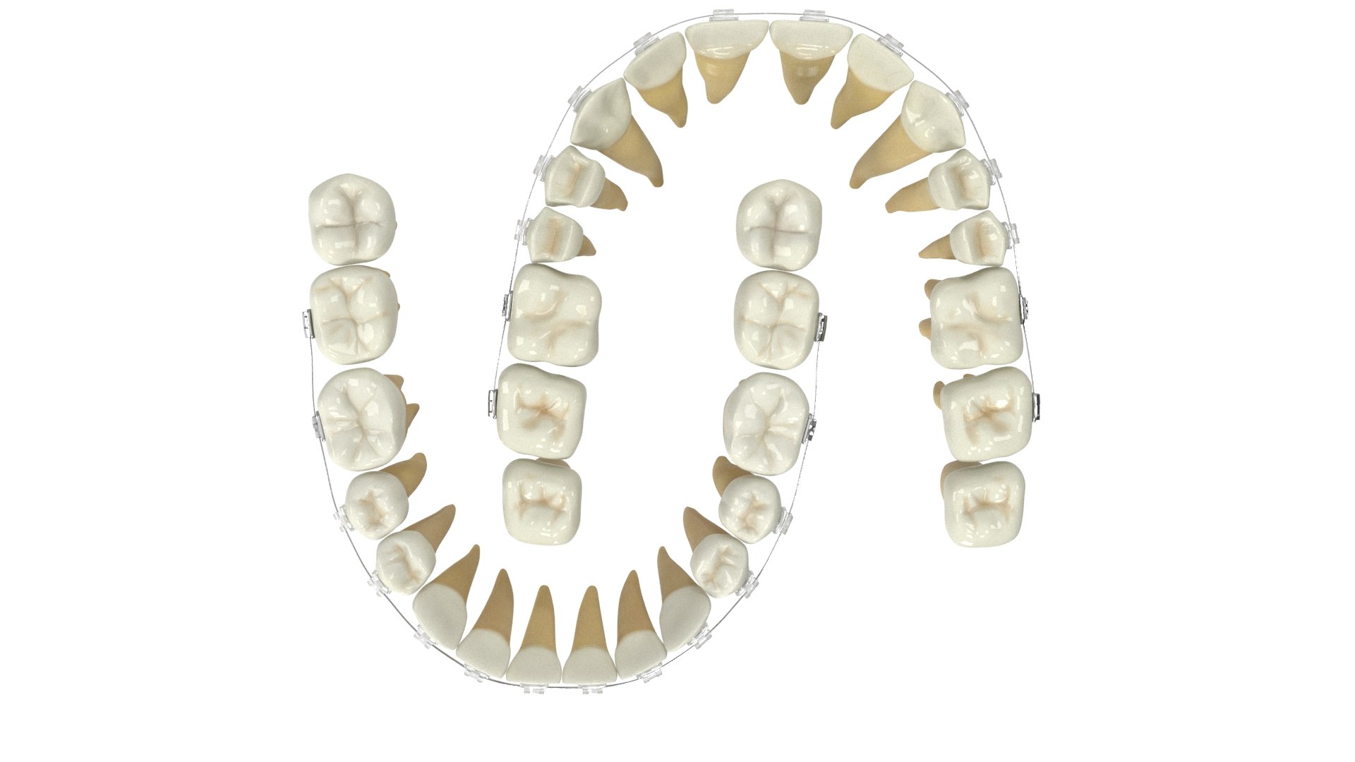 3D Human Teeth With Self Ligating Transparent Dental Braces V03 ...