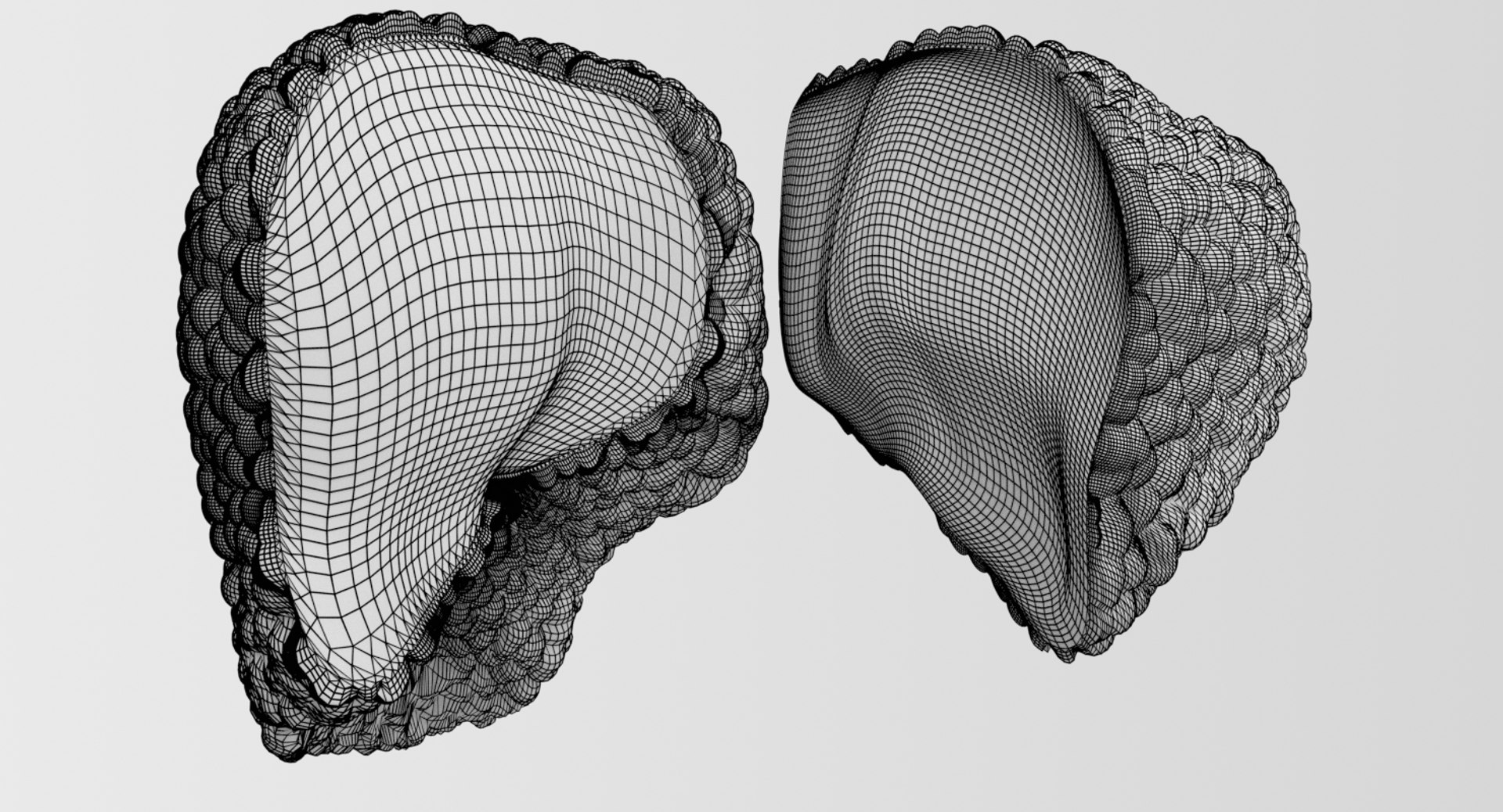 3D Alcoholic Liver Disease Fatty Model - TurboSquid 1382254